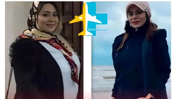 Bariatric surgery in Iran before/after - Iran Surgery Center